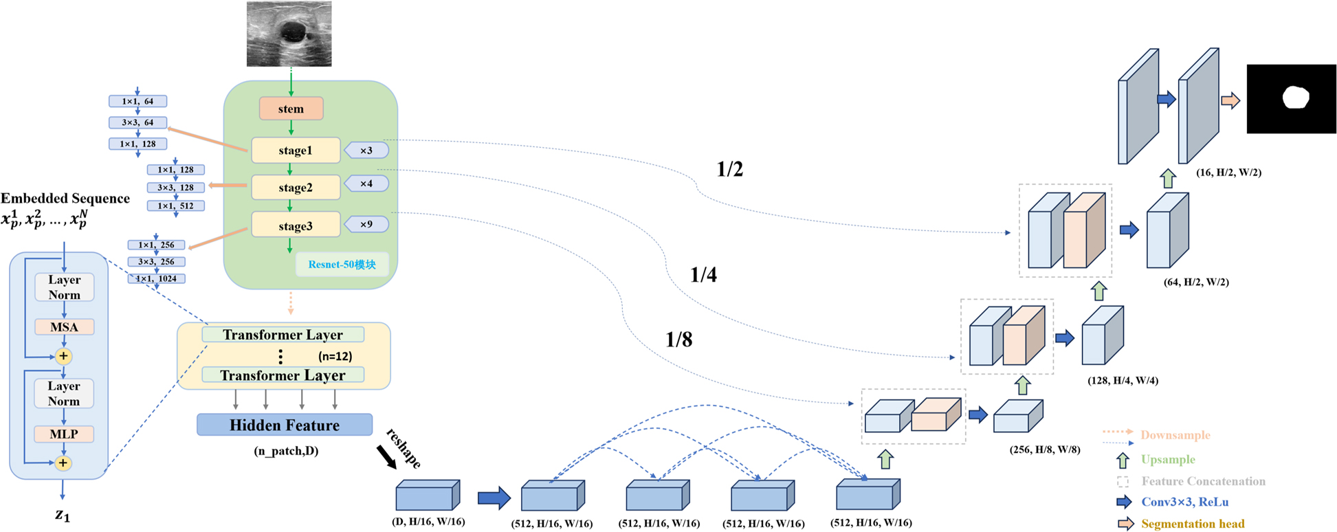 D-TransUNet: A Breast Tumor Ultrasound Image Segmentation Model Based on Deep Feature Fusion | JAIMS