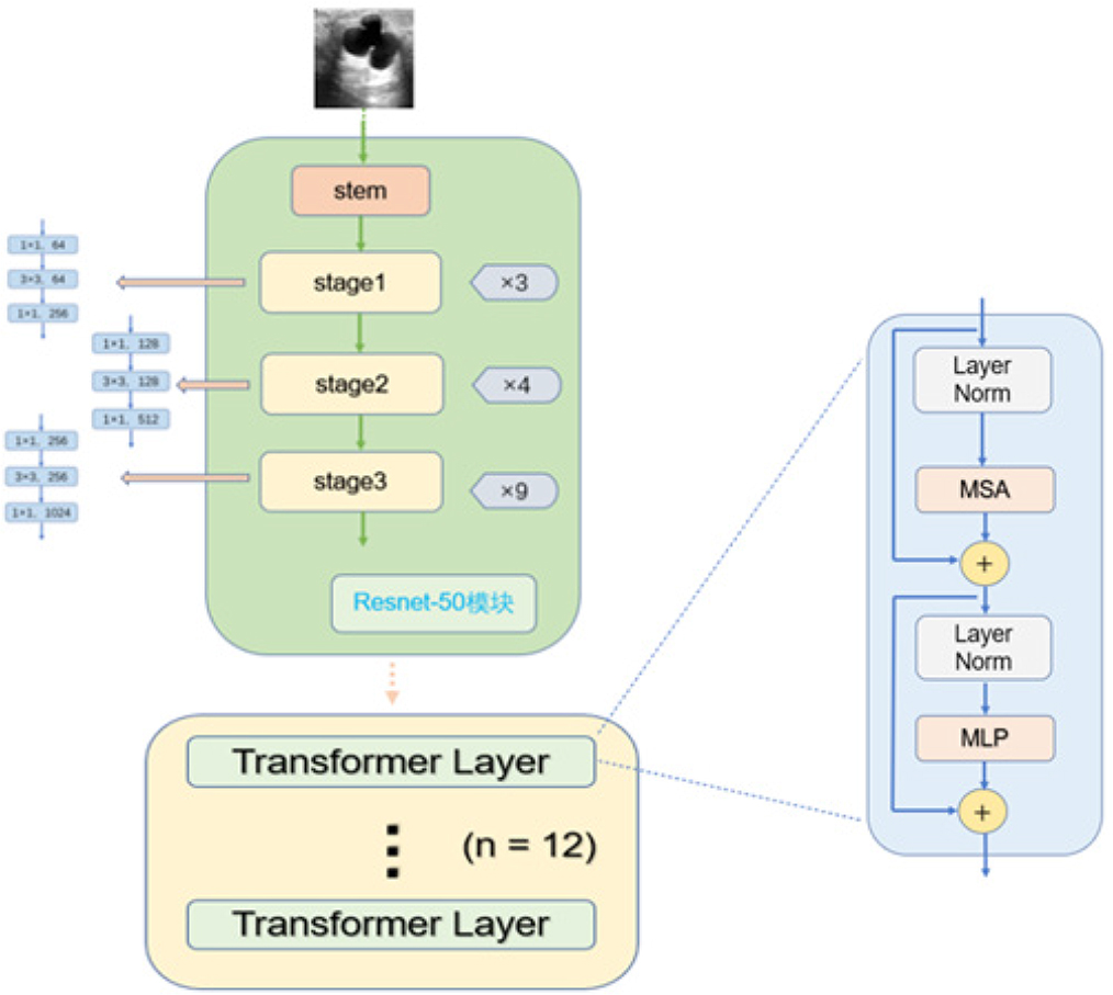 D-TransUNet: A Breast Tumor Ultrasound Image Segmentation Model Based on Deep Feature Fusion | JAIMS